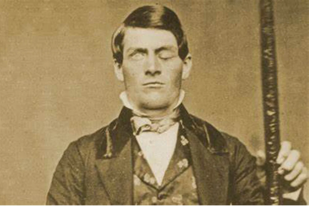 Phineas Gage, The Man Who Survived a Hole Through His Head